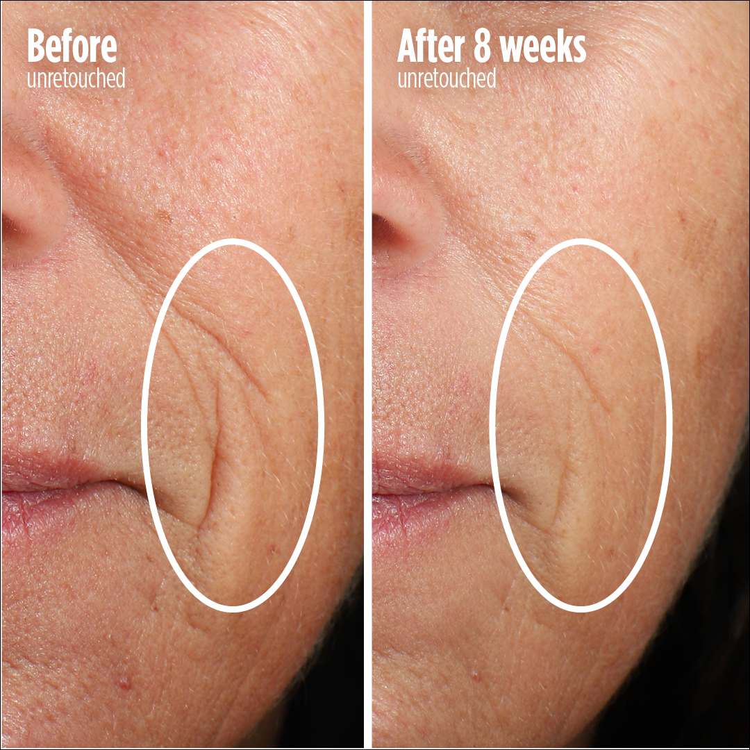 Shark™ CryoGlow™ Red Blue & Infrared iQLED Face Mask & Under Eye Cooling - (Blue Frost) - LED ...